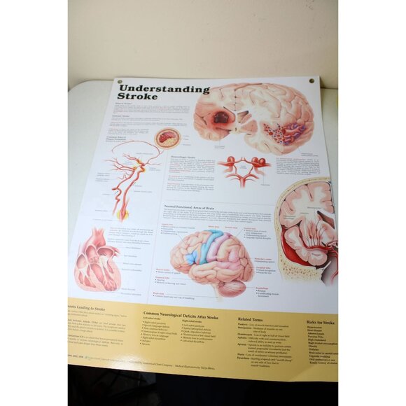 Art | Wolters Kluwer Understanding Stroke Chart Schematic 91283 | Poshmark